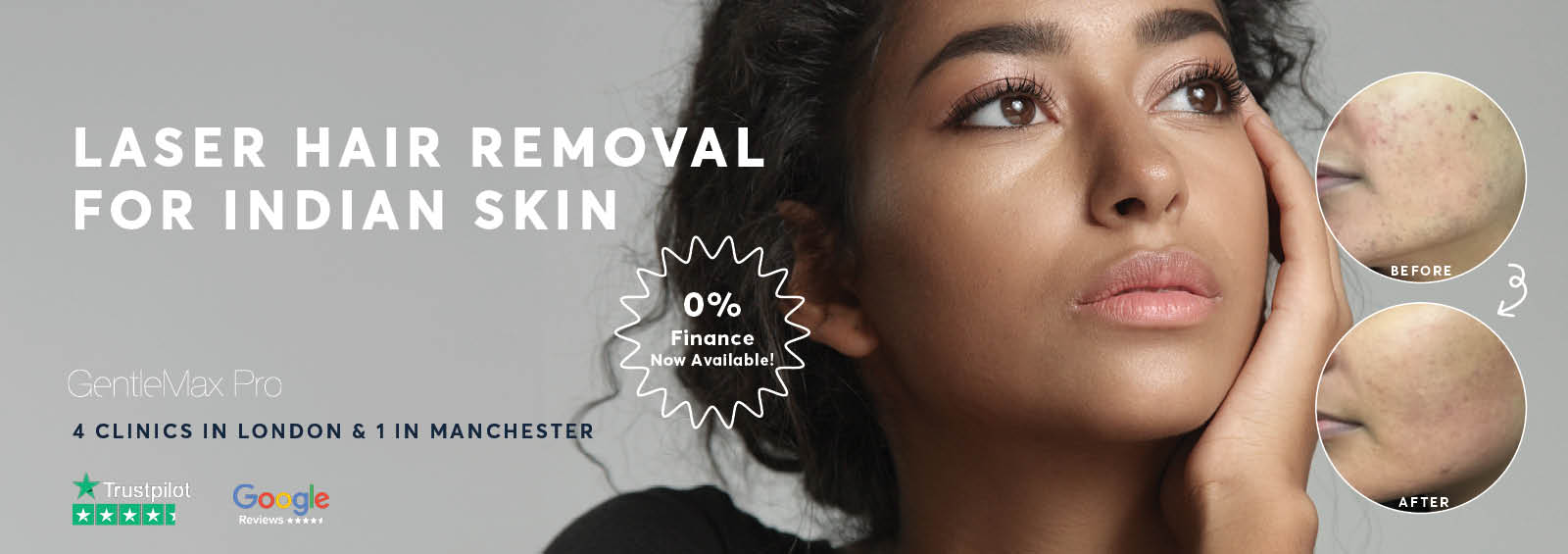 Laser Hair Removal Indian Skin Pulse Light Clinic London