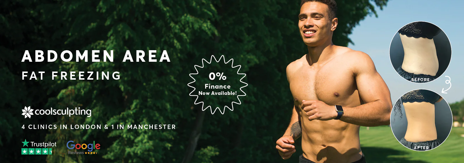 CoolSculpting Fat Freezing Abdomen | Pulse Light Clinic London