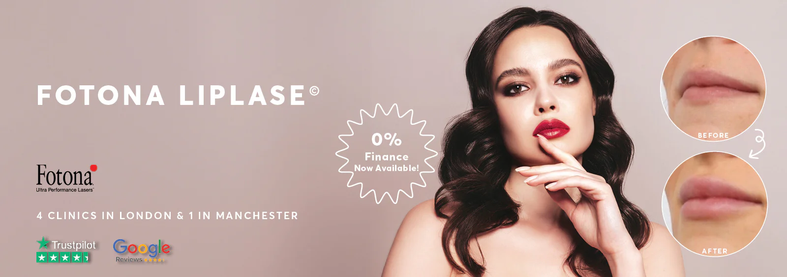 Fotona LipLase | Pulse Light Clinic London